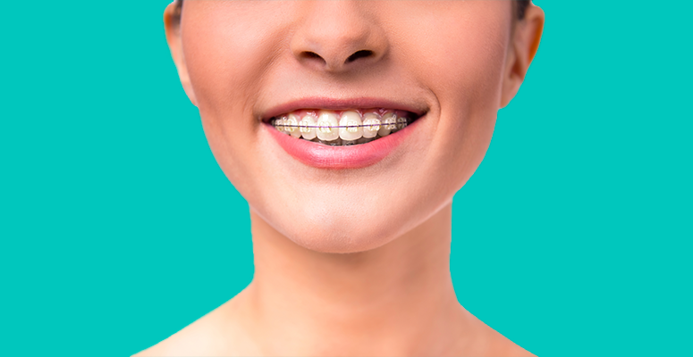 La ortodoncia es más que una linda sonrisa | Blue Medical Guatemala